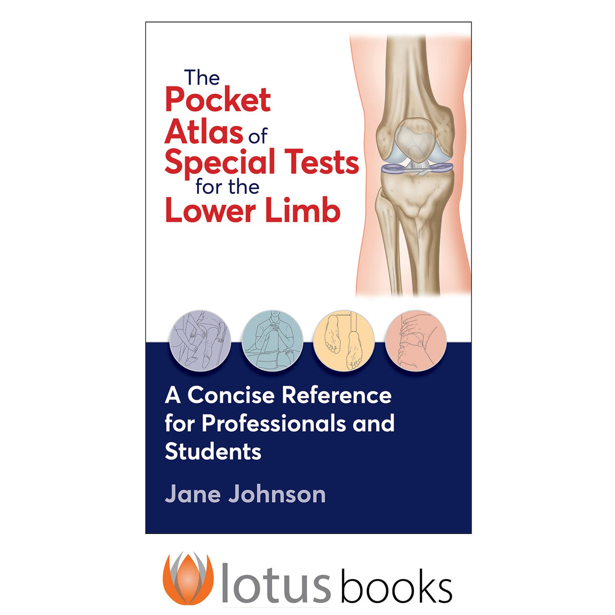 Using the Lachman’s Test to assess ACL stability – Human Kinetics Canada